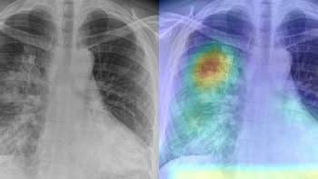 behold.ai’s red dot® AI algorithm identifies chest X-rays from COVID-19 ...